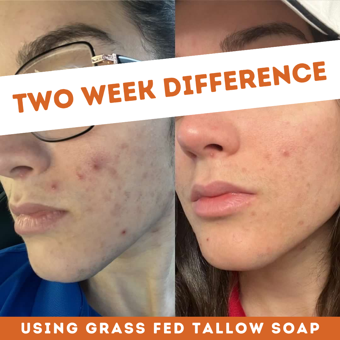 Health y Sol : The Most Delicious Bar of Soap